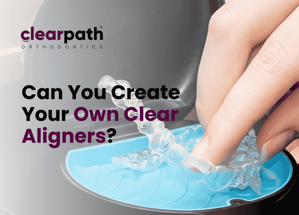 Can You Create Your Own Clear Aligners? - ClearPath Ortho