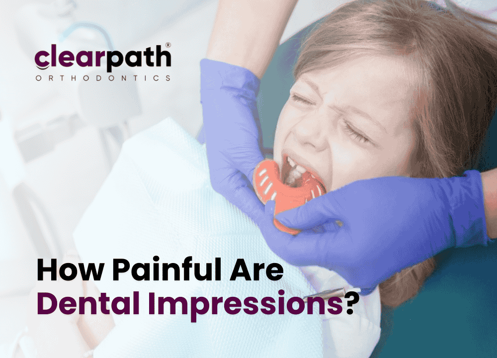 How Painful Are Dental Impressions? What You Need to Know