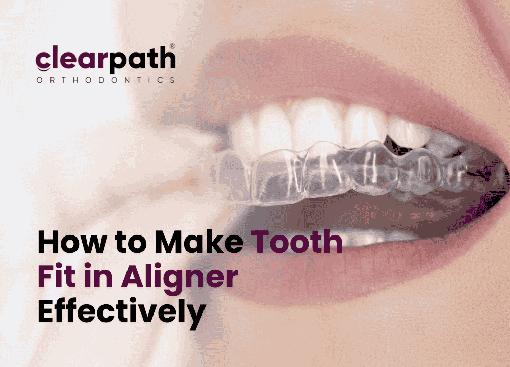 How to Make Tooth Fit in Aligner Effectively