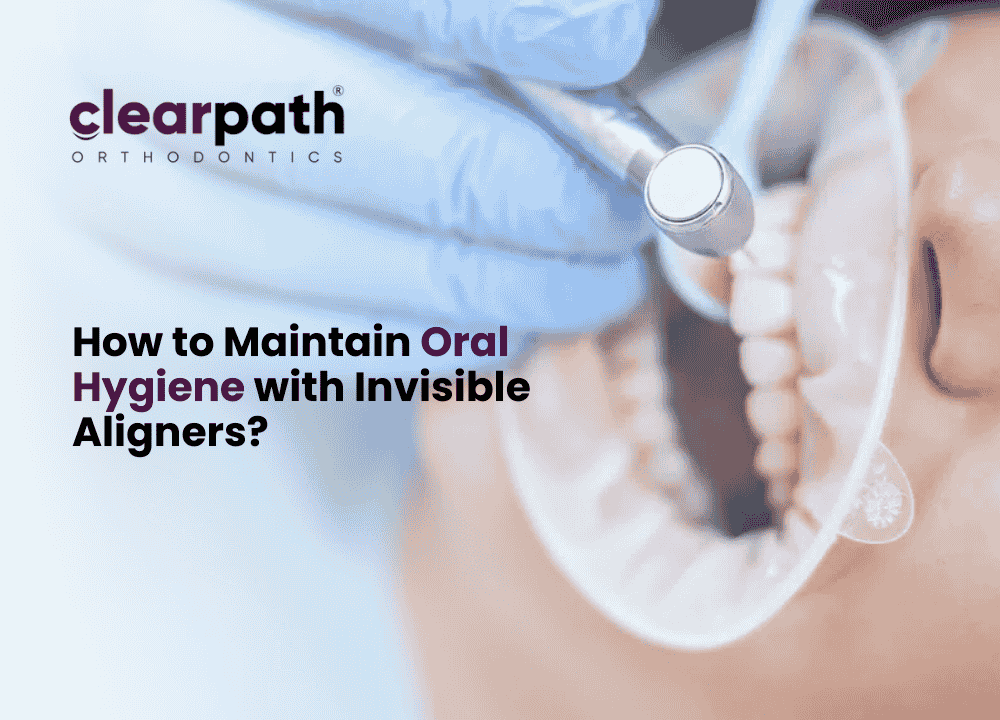 How to Maintain Oral Hygiene with Invisible Aligners?