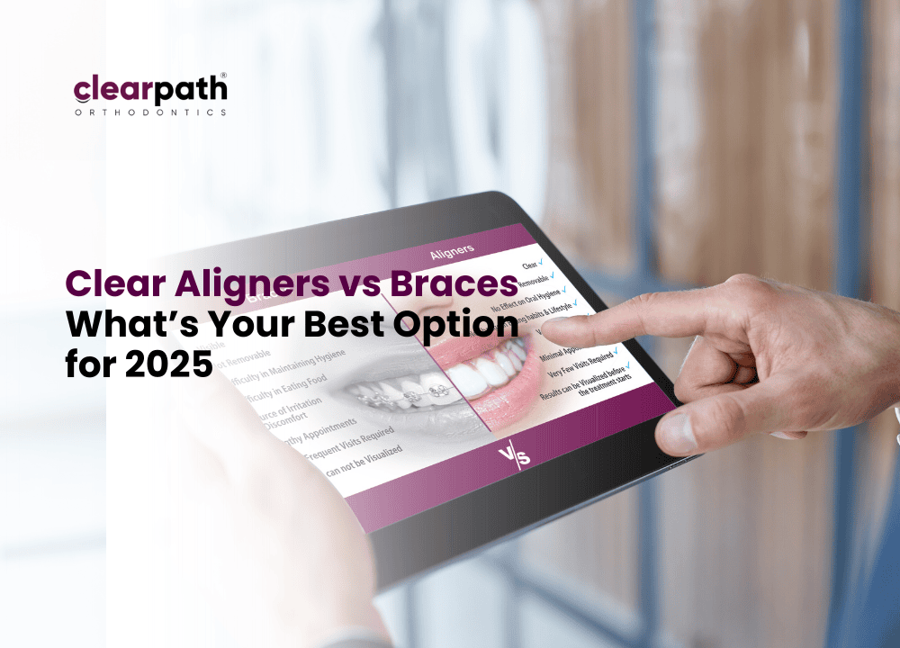Clear Aligners vs Braces: What’s Your Best Option for 2025?