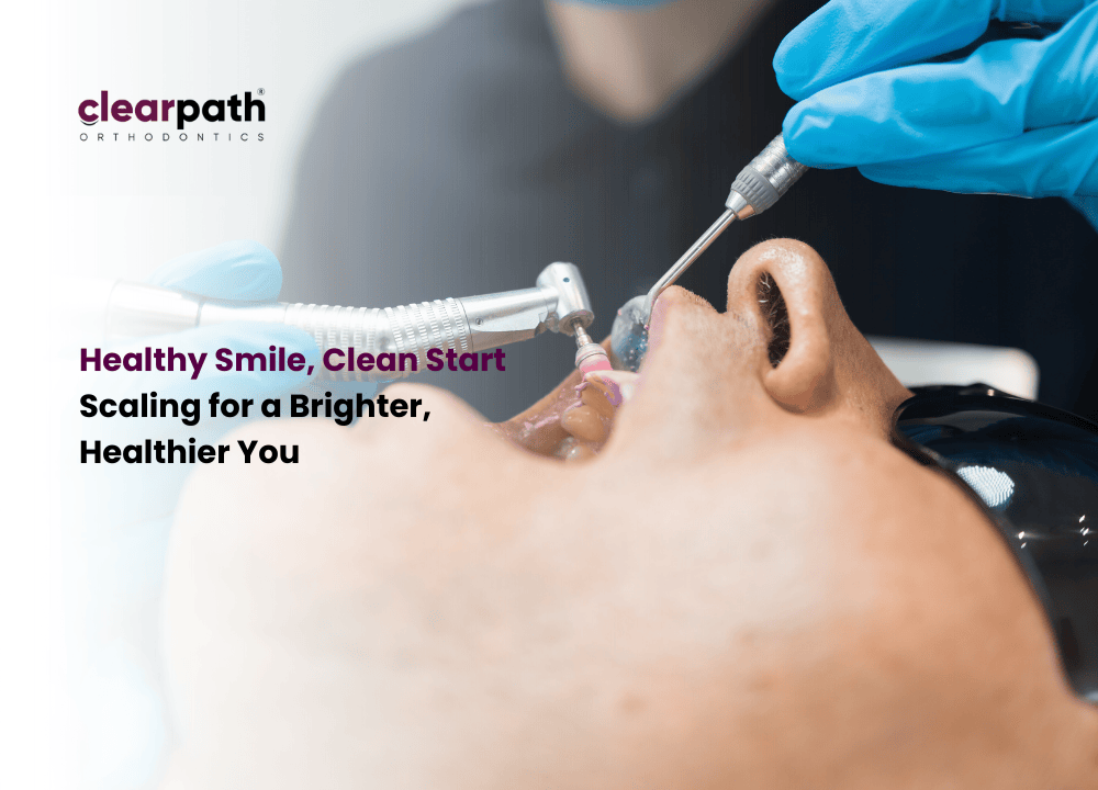 Scaling of teeth: Everything you should know - ClearPath