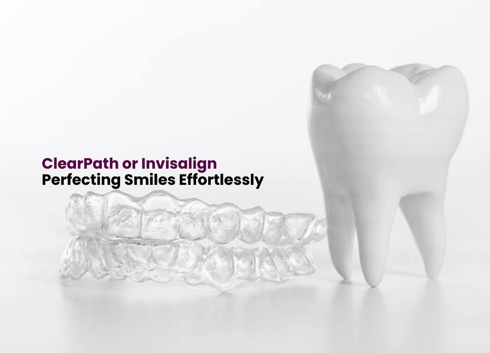 Looking for Clear Aligners vs Invisalign: A Smarter Choice