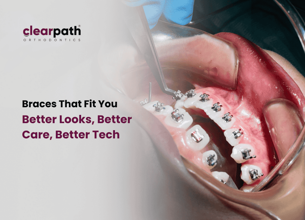 Best Dental Braces in Pakistan | ClearPath Ortho