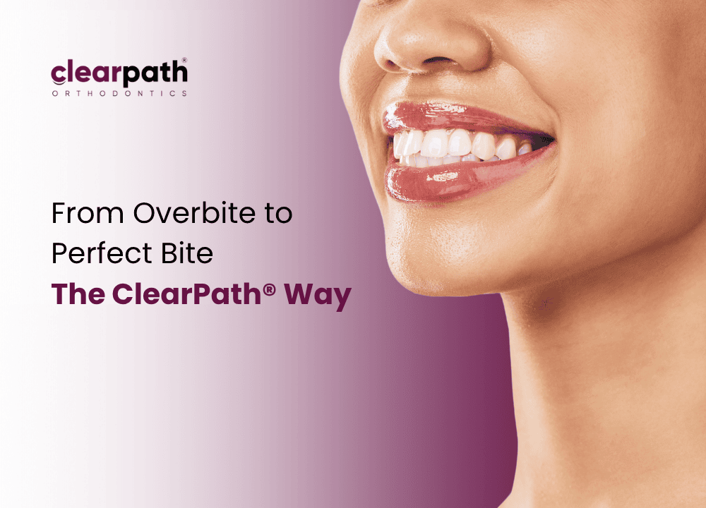 ClearPath® Aligners for Overbite – Before & After Results